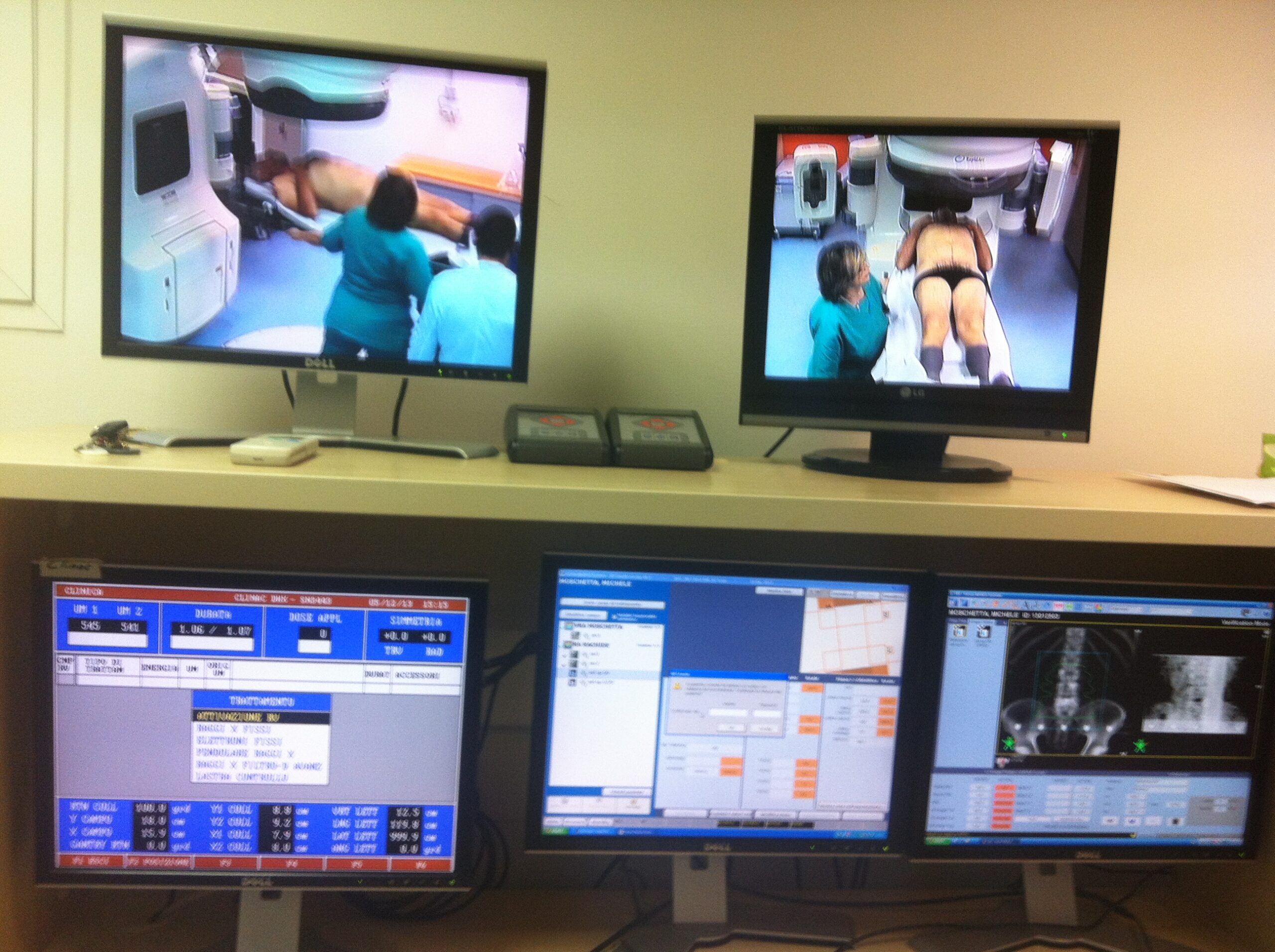 RapidArc: la radioterapia diventa più rapida e precisa | GoSalute