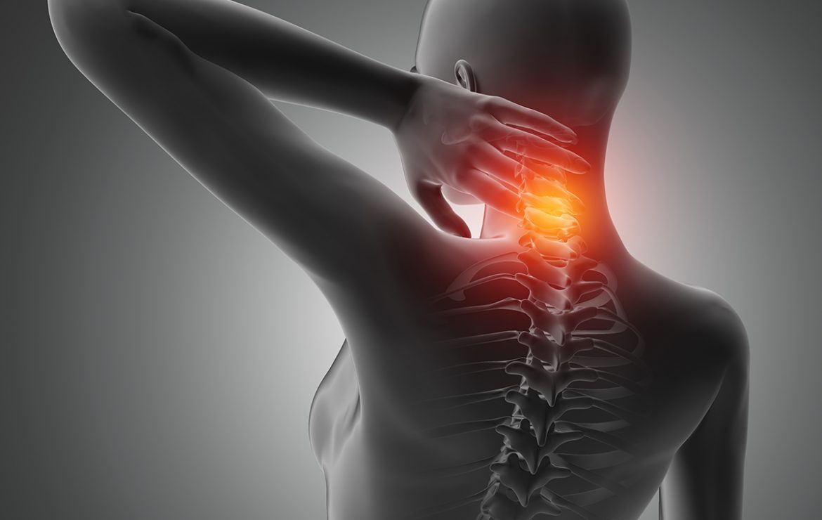 Dolore cervicale: cause e rimedi | GoSalute