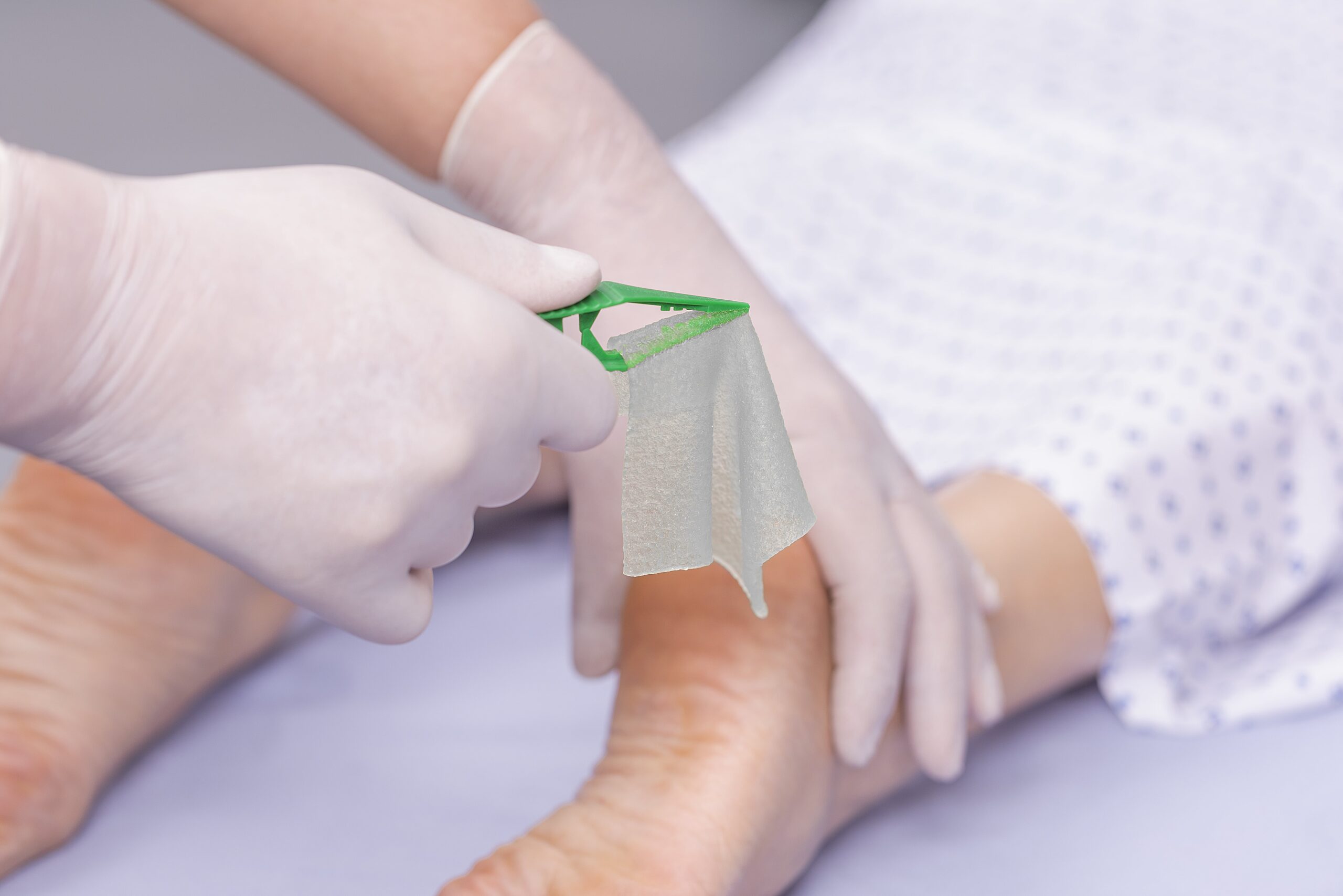 Come trattare le ferite croniche e fortemente essudanti | GoSalute