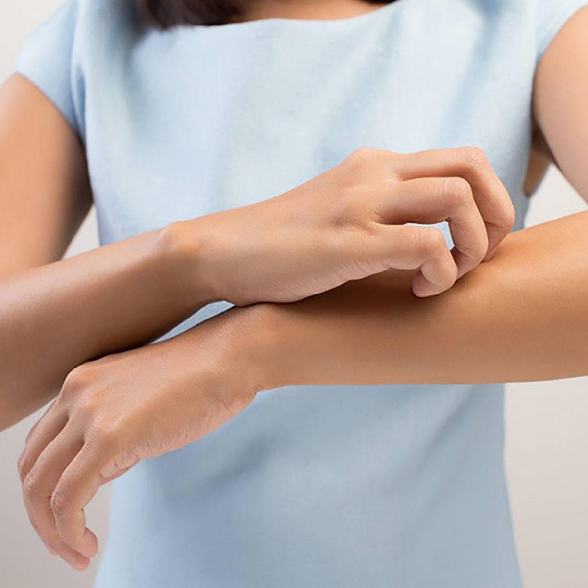 Psoriasi mani come inizia e rimedi efficaci | GoSalute